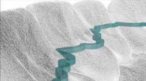 Contention Parodontale - Mon Cabinet Dentaire